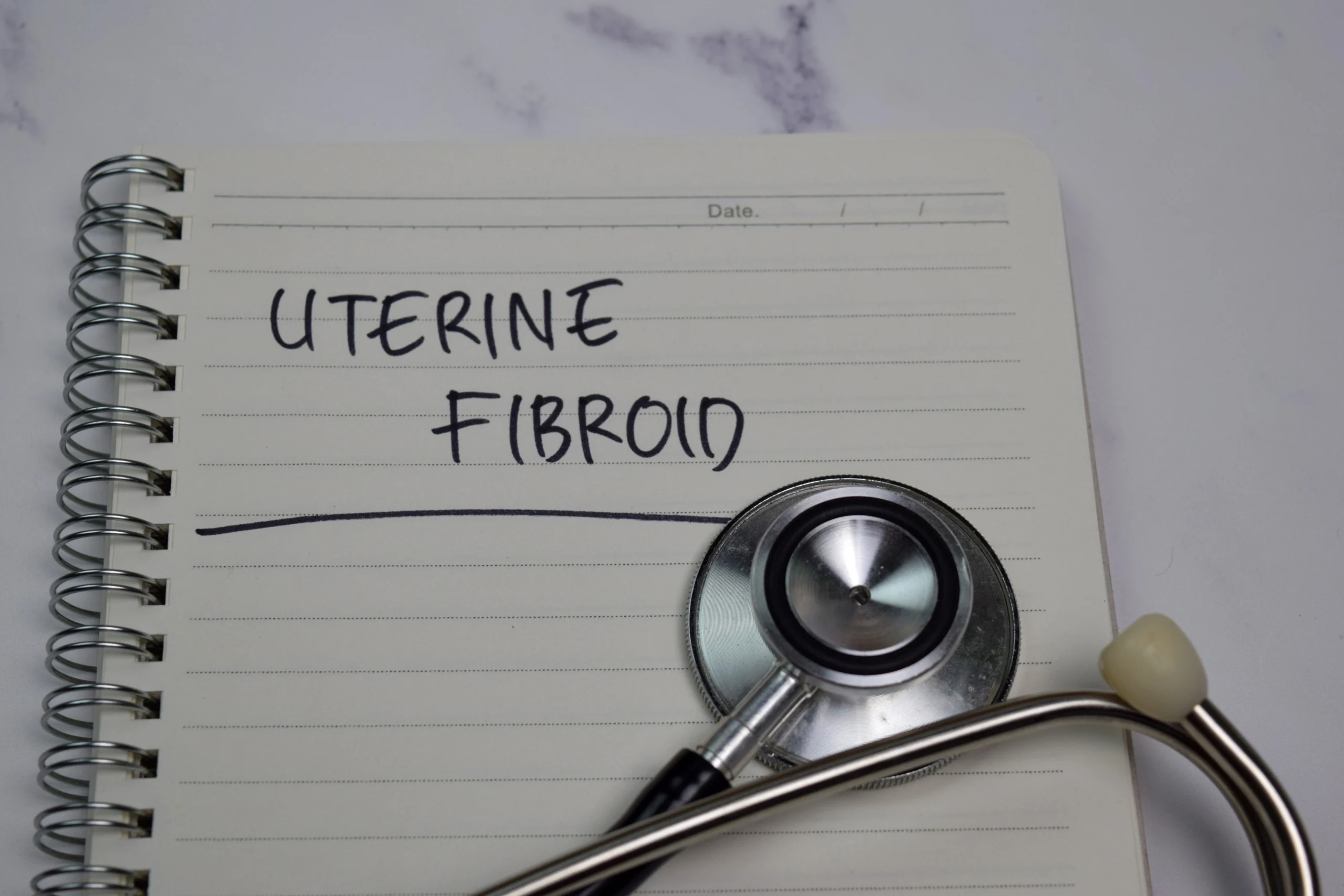 Uterine Fibroids – Heavy Period Bleeding – San Antonio OBGYNs