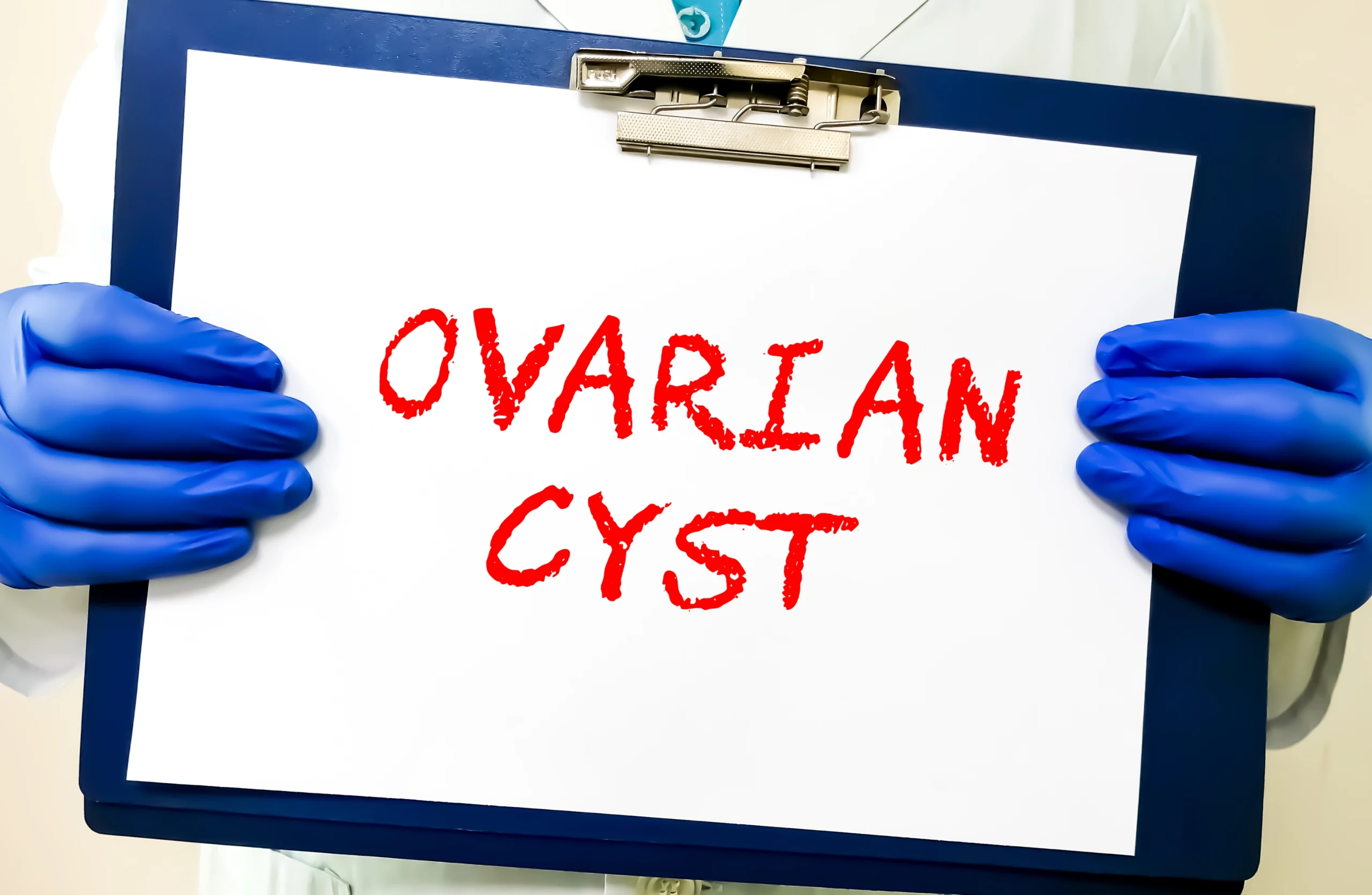 Ovarian Cysts – San Antonio OBGYNs – Functional Cysts