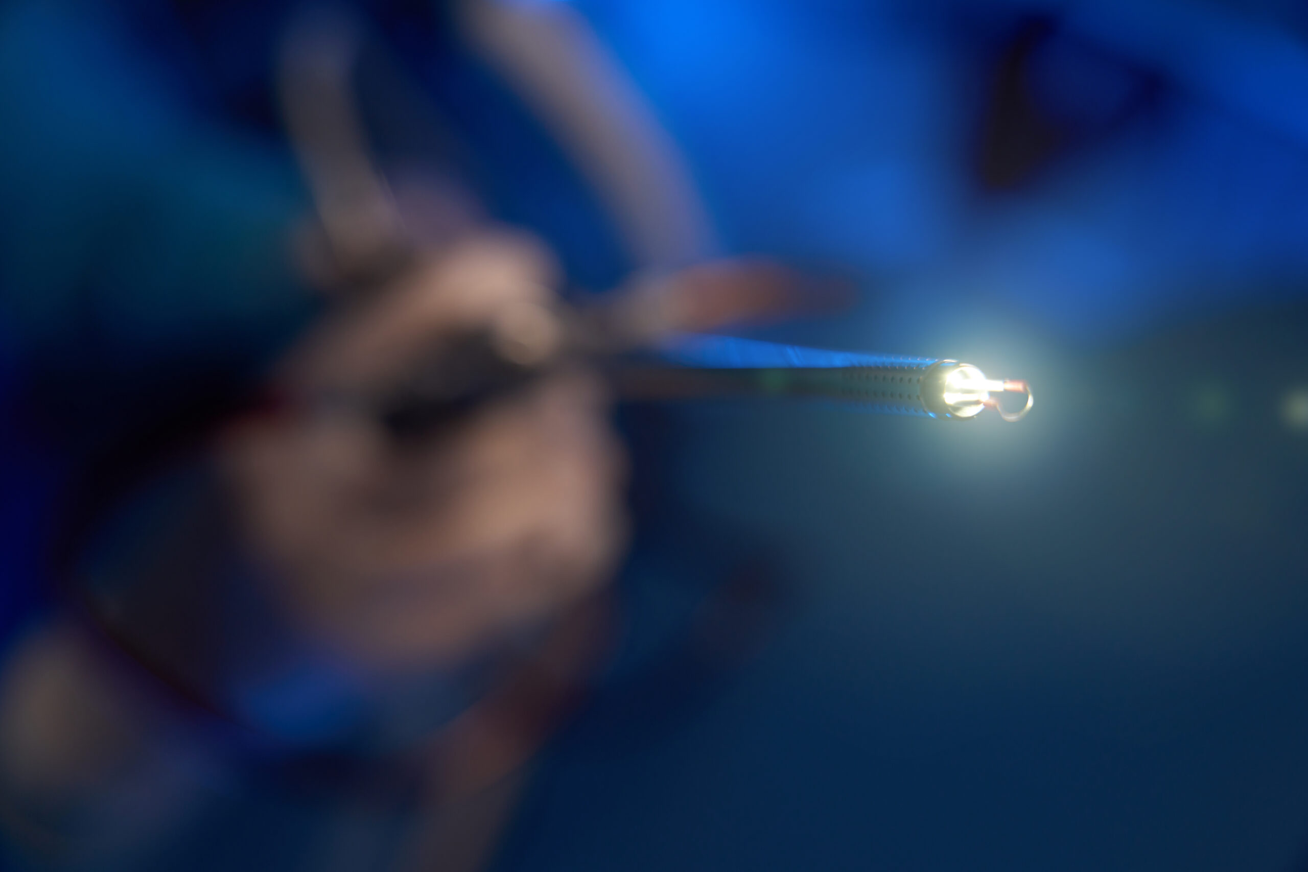 Advice for a Hysteroscopy – San Antonio OBGYNs – Examination of the Uterus